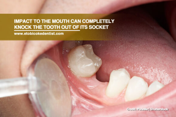 What You Need to Know About Tooth and Mouth Injury - Dr. Mark Rhody ...