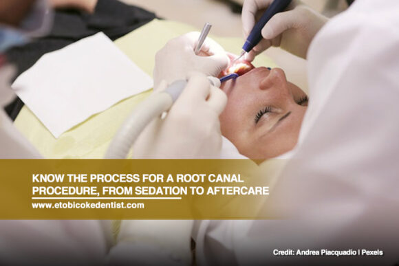 What to Expect From a Root Canal Procedure - Dr. Mark Rhody Dentistry